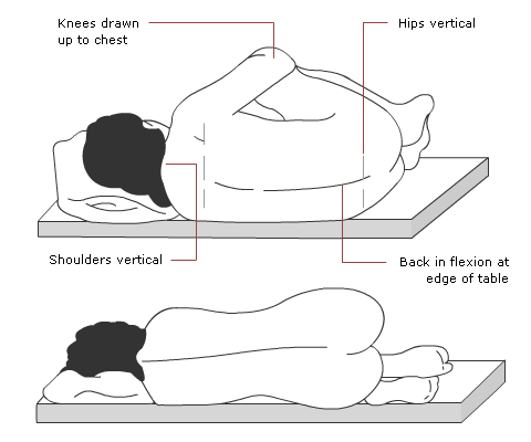 Fig 2 The lateral position